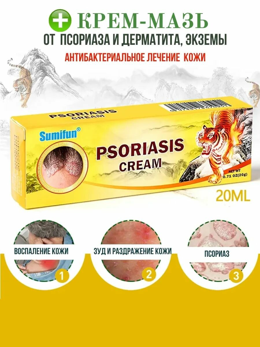 Крем для кожи от псориаза, экземы, атопического дерматита / китайская народная медицина