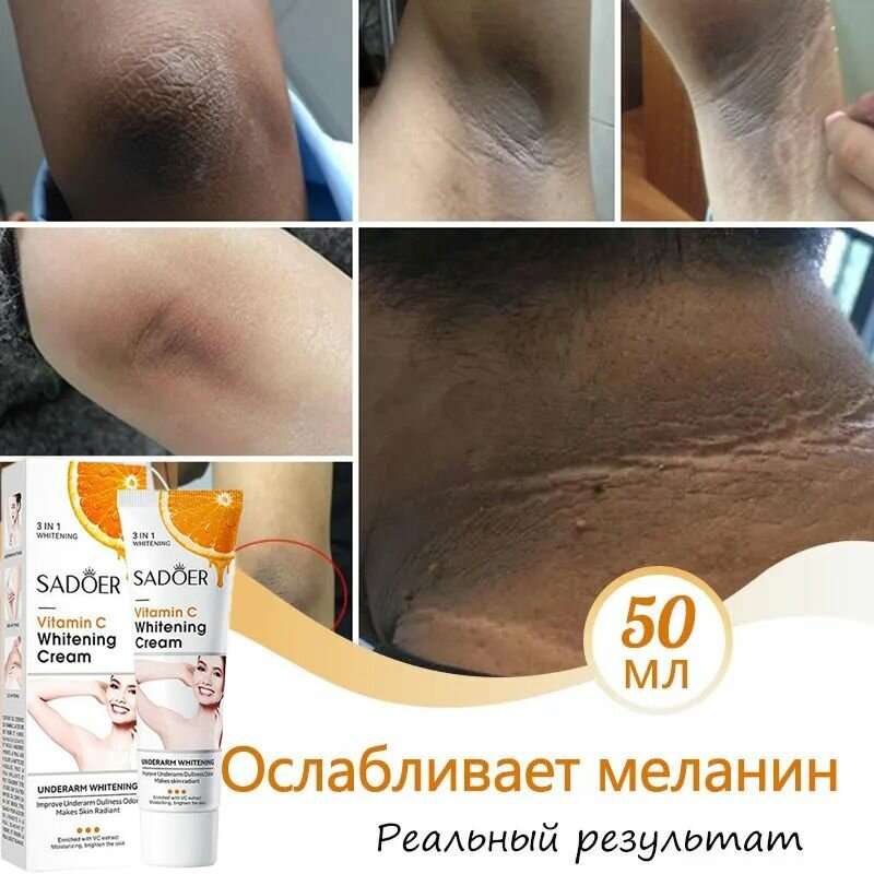 Для подмышек, интимных мест, тела, ягодиц, крем для отбеливания бикини 50г Содержит витамин С для предотвращения пигментации