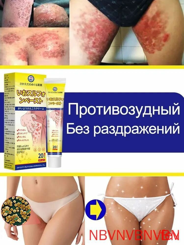 Тело крем от псориаза Противозудное, антибактериальное средство при экземе и герпесе