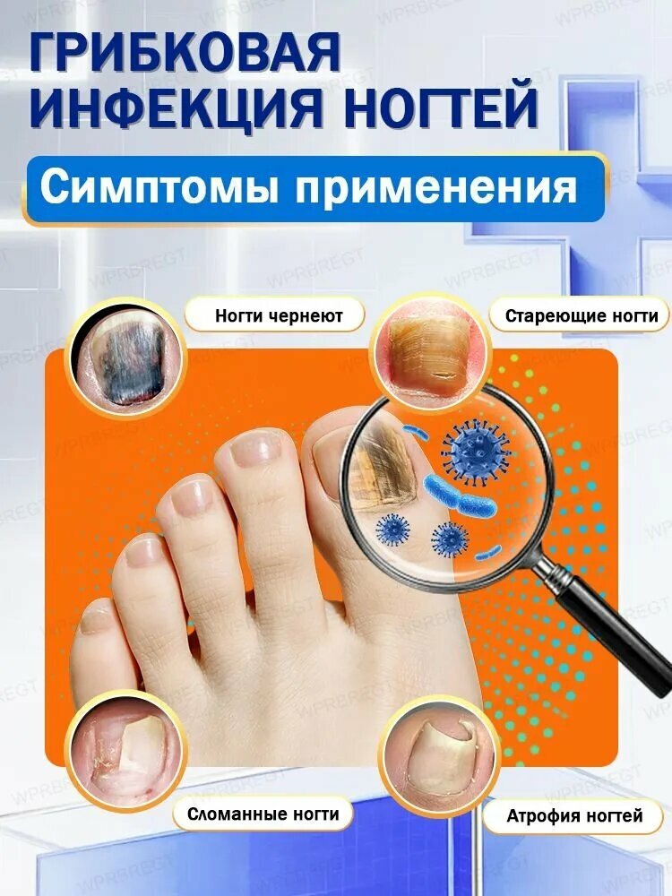 Лазерное лечение онихомикоза может разрушить структуру грибка, а также устранить такие симптомы, как пожелтение, утолщение, растрескивание, отек и зуд ногтей, способствуя здоровому росту ногтей.