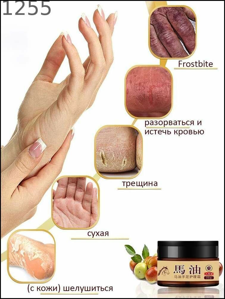 Первая помощь пяточкам! Крем с мочевиной 40% и конским жиром 35г. Глубокие трещины исчезают за 5 дней, экстренное смягчение огрубевшей кожи, защита от рецидивов11