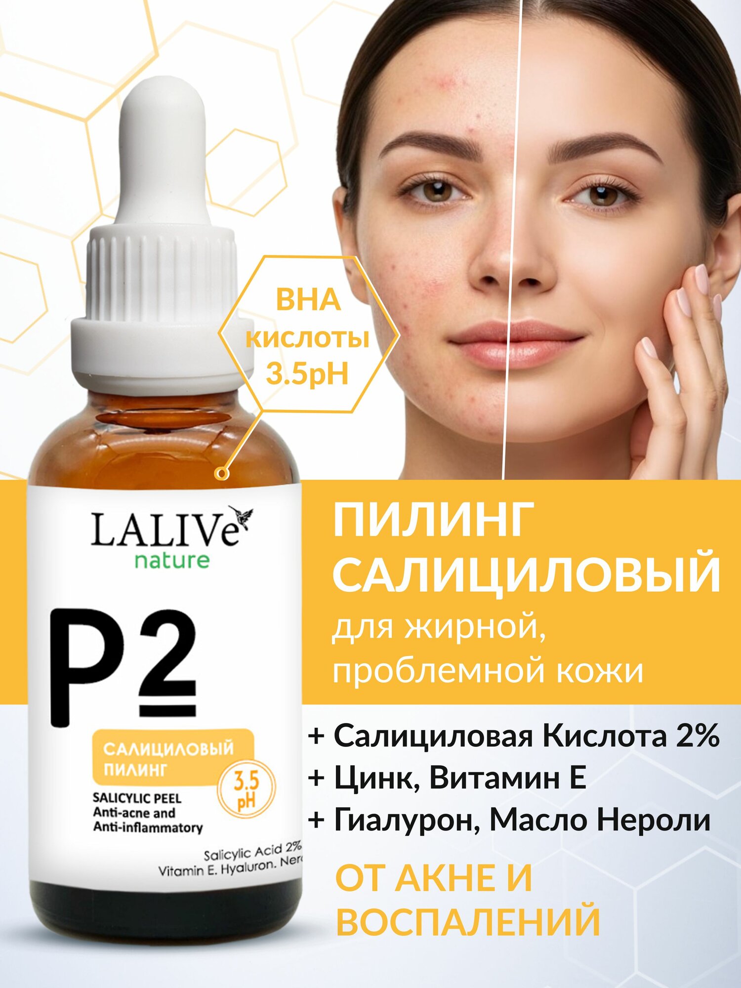 Салициловый пилинг для лица 2% BHA, кислотный эксфолиант от прыщей и черных точек, для жирной и проблемной кожи, LALIVe R2