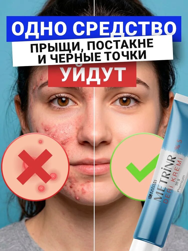 Крем от прыщей на лице Metrinr / От акне и постакне, для проблемной кожи лица, от шелушения, от покраснений, от пигментации, Metrin / 30 мл