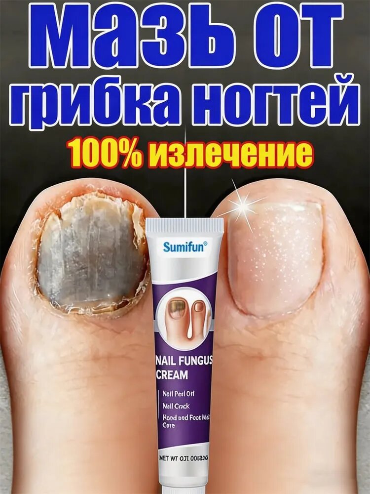 Лечение грибковых инфекций ногтей, Увидите эффект через 7 дней. Противогрибковое средство от грибка ногтей Ноготок