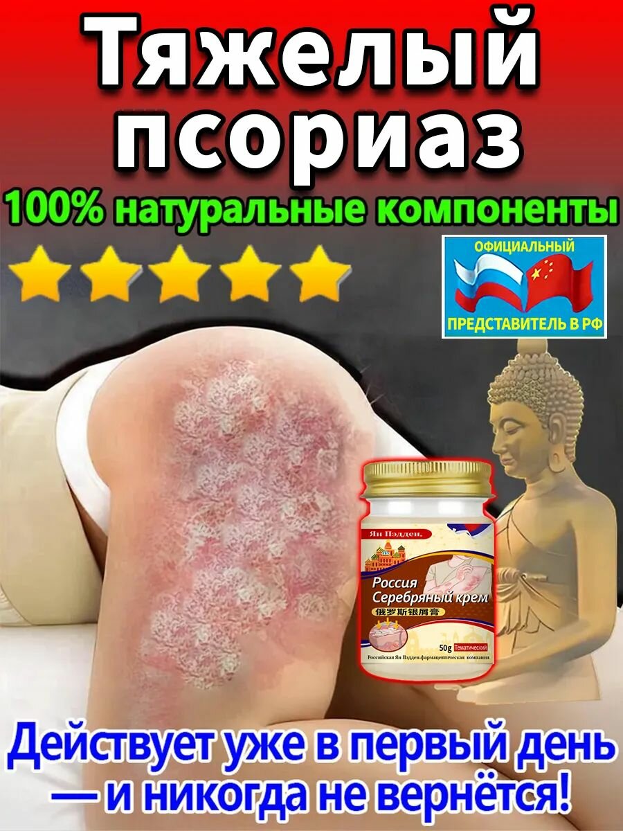 Мазь от псориаза, предназначенная для лечения псориаза, экземы, нейродермита, грибковых заболеваний, дерматита, себорейного дерматита, быстро восстанавливает здоровье кожи, 50 мл