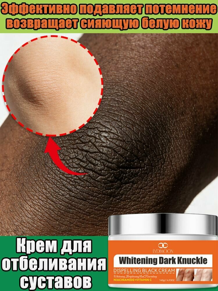 Крем от пигментных пятен, 140 г удаляет меланин, уменьшает гиперпигментацию, для тела, для подмышек, локтей