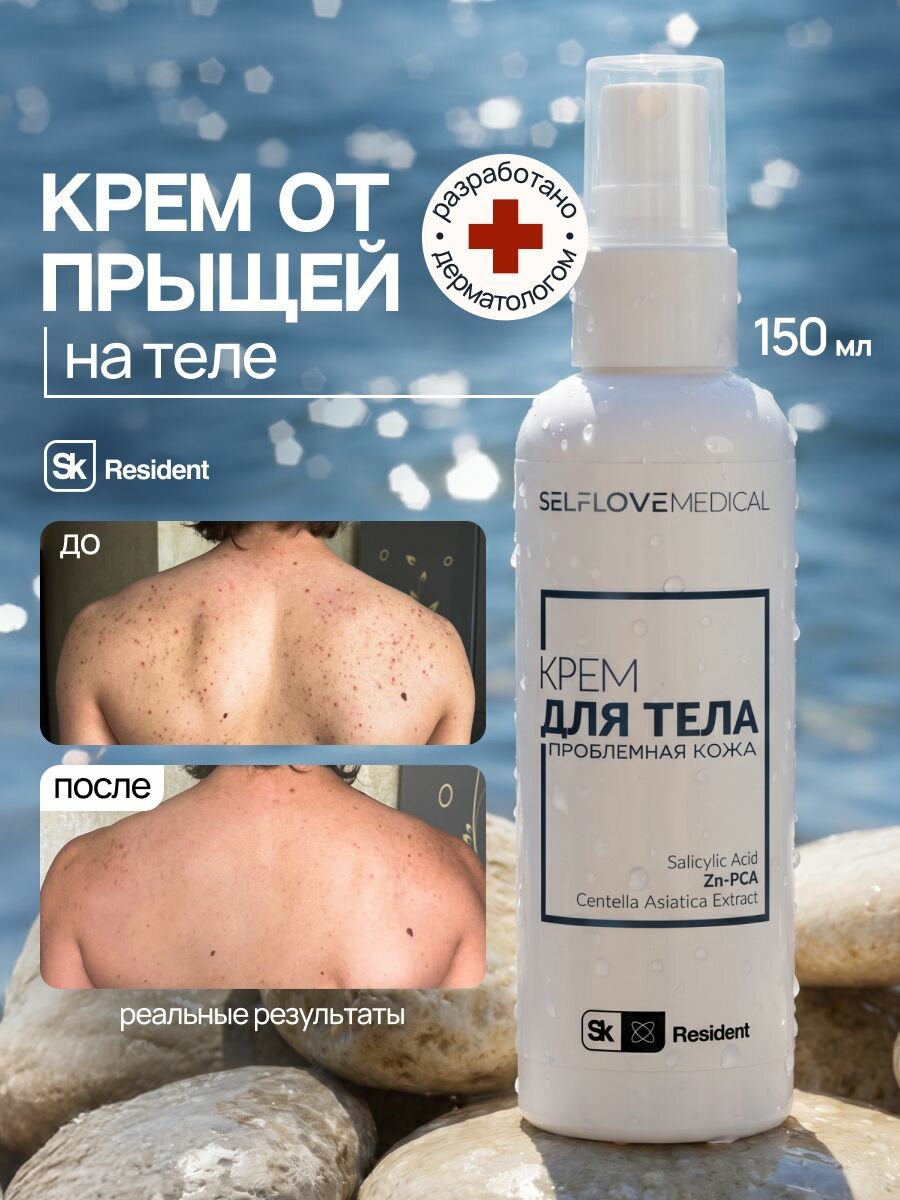 BODY крем SelfLoveMedical крем для тела от высыпаний, акне и воспалений с салициловой кислотой, цинком, ниацинамидом и экстрактами растений