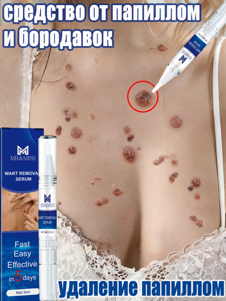 MR&MISS папиллом и родинок, безболезненно, без шрамов и побочных эффектов. Карандаш для удаления бородавок, быстро, без побочных эффектов,3мл