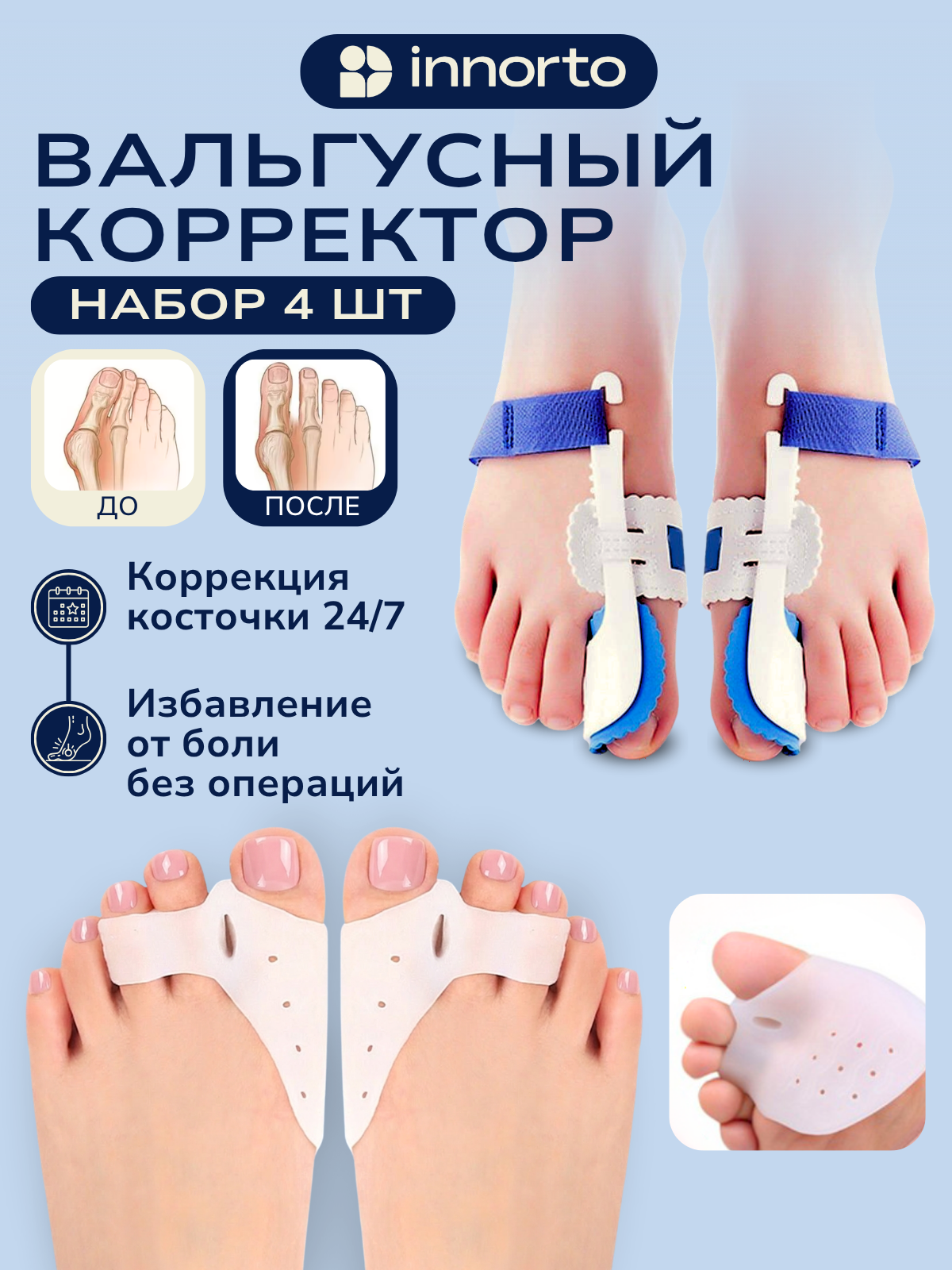 Набор от косточки большого пальца