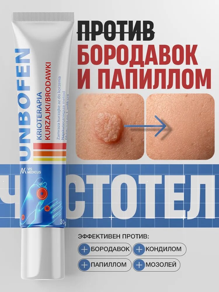UNBOFEN от папиллом / Крем от бородавок, чистотел от папиллом, для тела, для рук, для шеи, чистотел от бородавки, от сухих мозолей, Undofen от бородавок / 30 мл