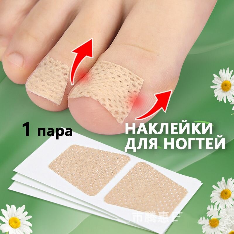 Пластырь для ухода за ногтями, защита пальцев ног, коррекция паронихита