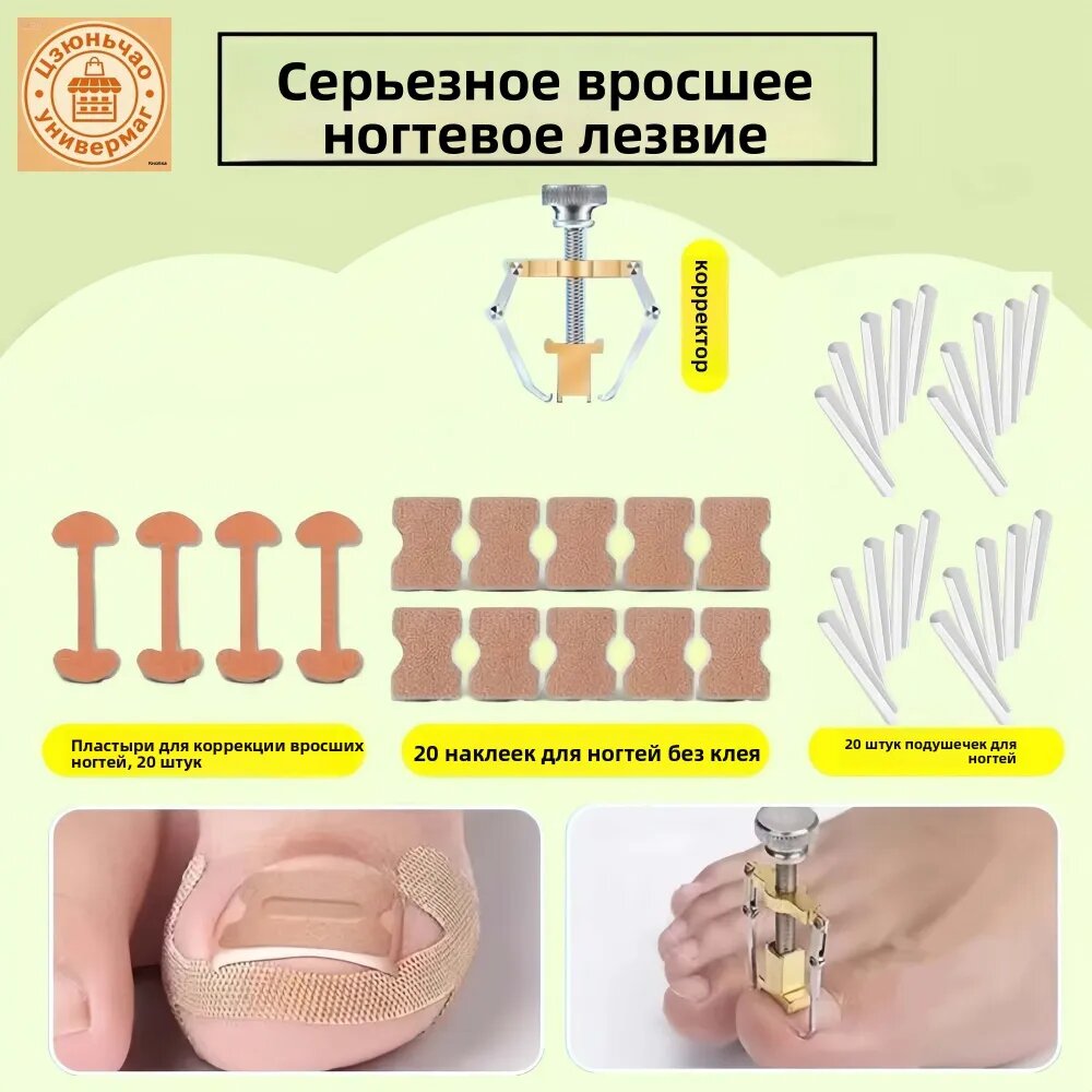 Корректор для исправления врастания ногтя с прокладками, набор для лечения паронихии и врастания ногтя на пальцах ног