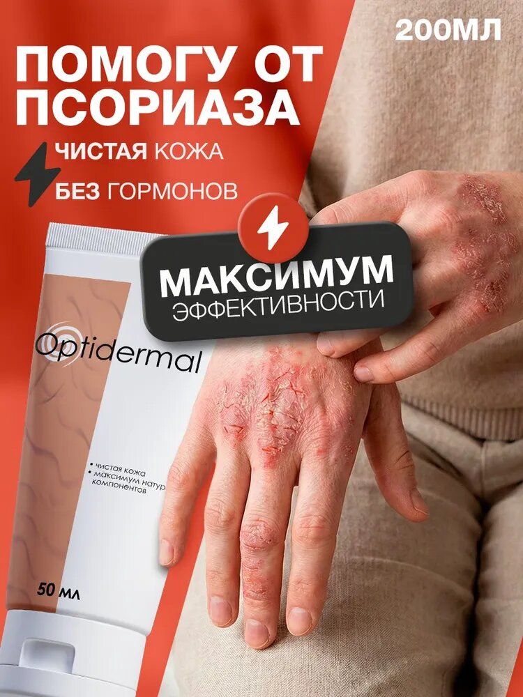 Оптидермал / Крем от псориаза, мазь от экземы, дерматит, мазь от псориаза на голове / 50 мл