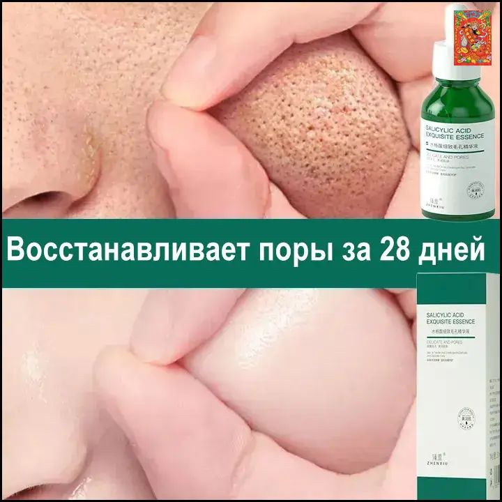 Сыворотка-эссенция для лица, Очищающий увлажняющий тоник для лица для сужения пор от прыщей угрей акне с гиалуроновой кислотой , Восстановление водного баланса, 30 мл