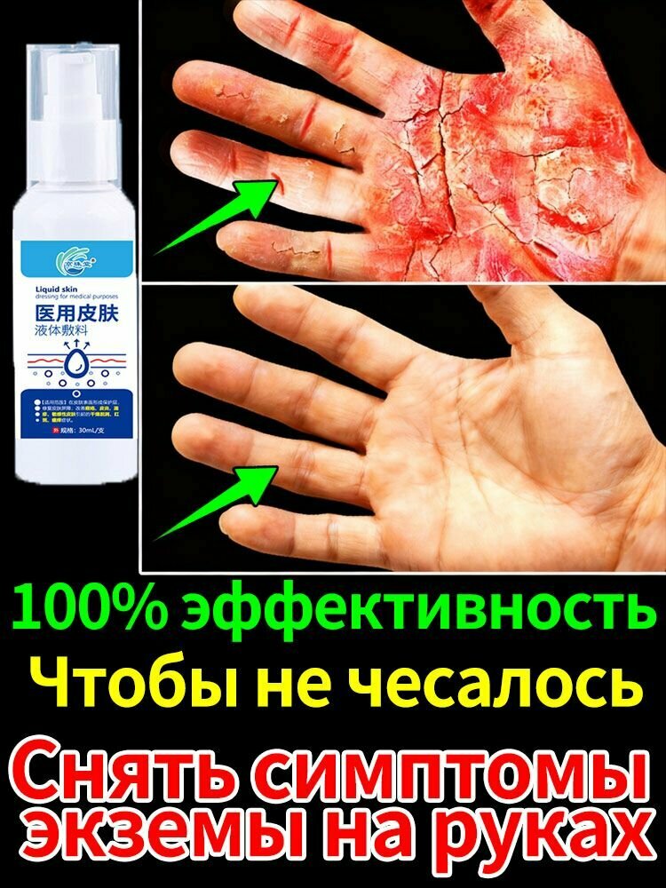 Мазь от атопического и себорейного дерматита, экземы, зуда и шелушения Дермотиатик Здраводерм