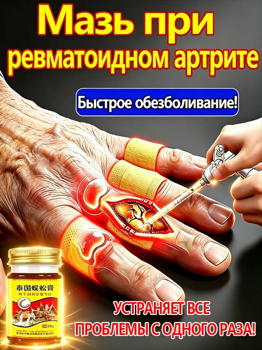 Мазь от артрита, Устранение боли при воспалении суставов, коленях, пальцах рук и т. д, на конечностях и для спины и артроза 55g