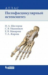 Полифасцикулярный остеосинтез: атлас / Шестерня Н. А, Иванников С. В, Макарова Е. В.