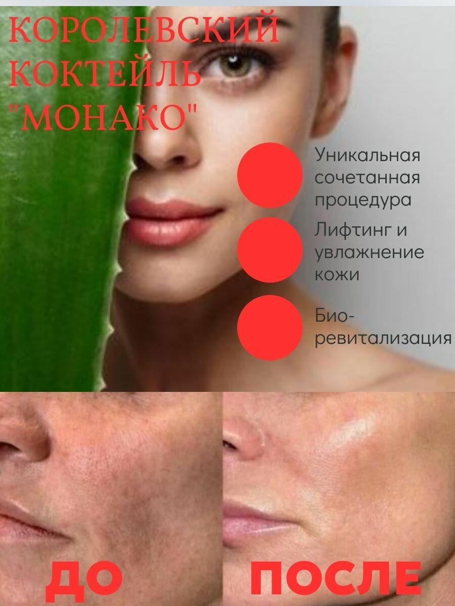 Королевский коктейль Монако Fusion Mesotherapy