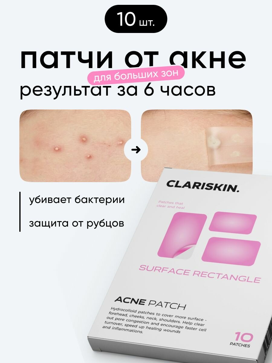 Патчи от прыщей и акне гидроколлоидные, для области лица и тела Clariskin 10 шт.