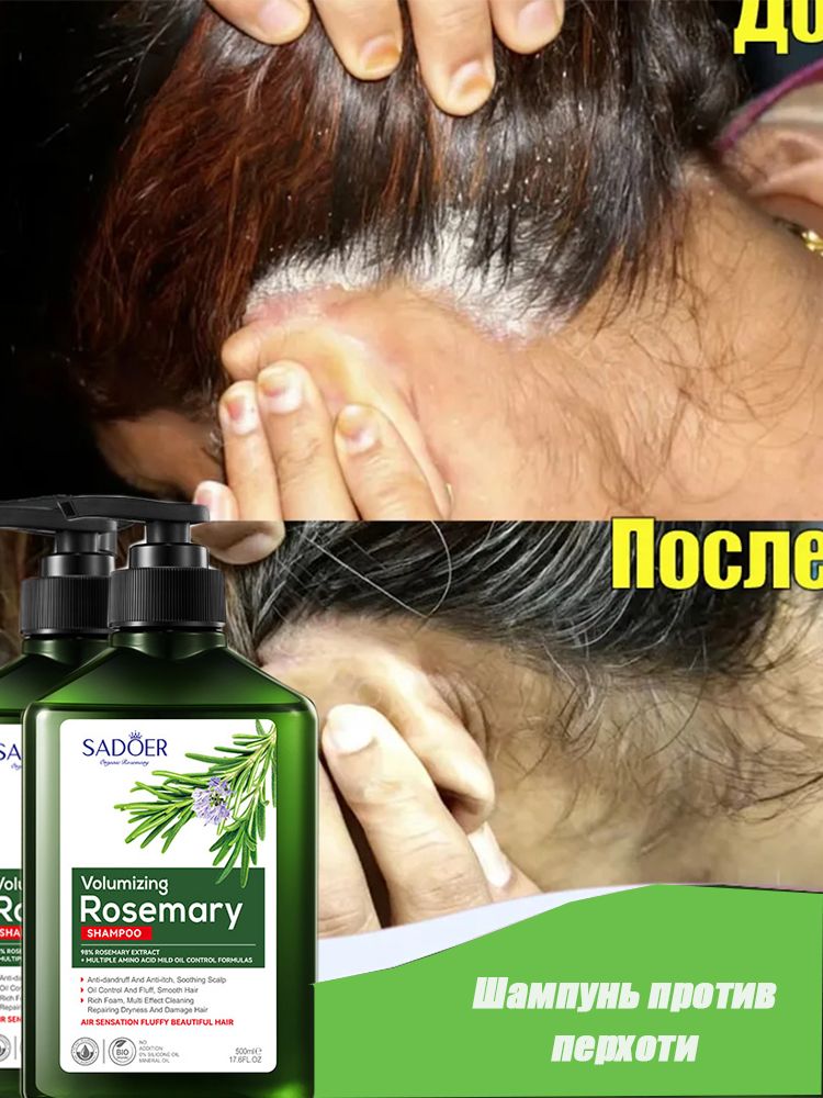 Улучшенный шампунь от перхоти, зуда и жирного блеска, подходит для ежедневного использования, 500 мл