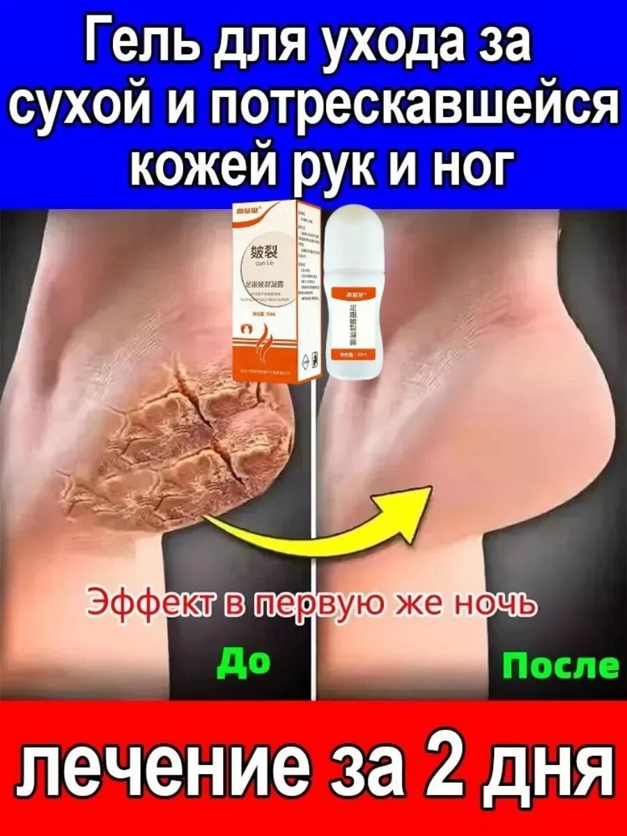 Айская чудо-мазь для лечения потрескавшейся кожи, 20 г