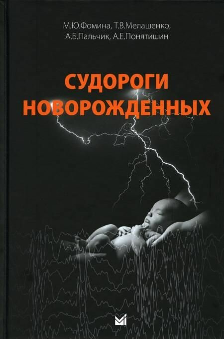 Судороги новорожденных. Пальчик А. Б, Мелашенко Т. В, Фомина М. Ю