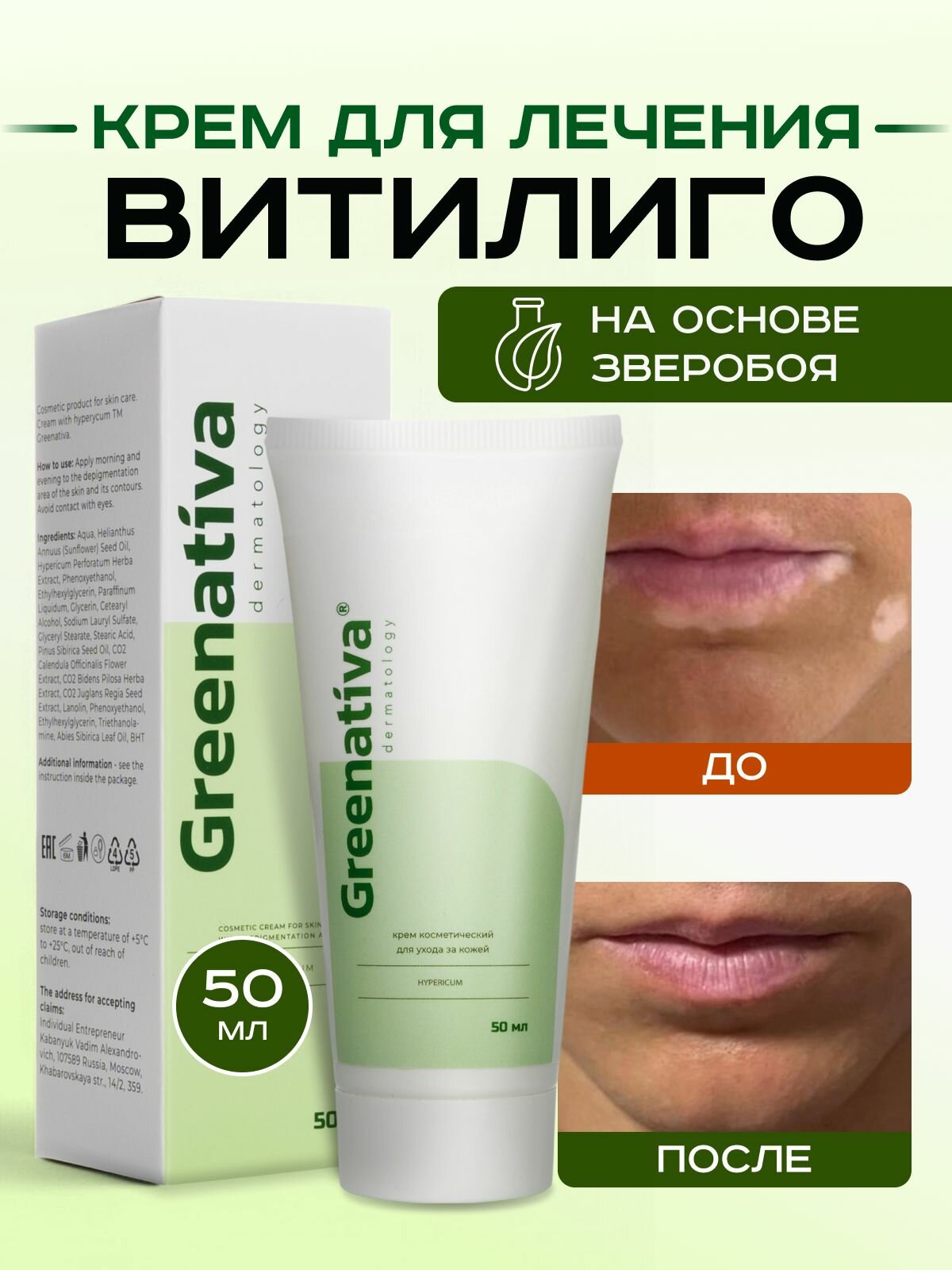 Мазь от витилиго кожи на основе зверобоя Greenativa 50 мл