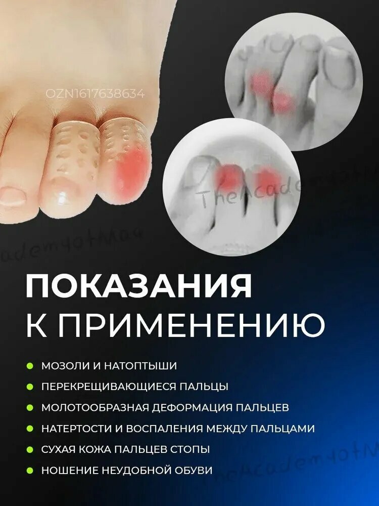 Резинка для варежек — фото 1