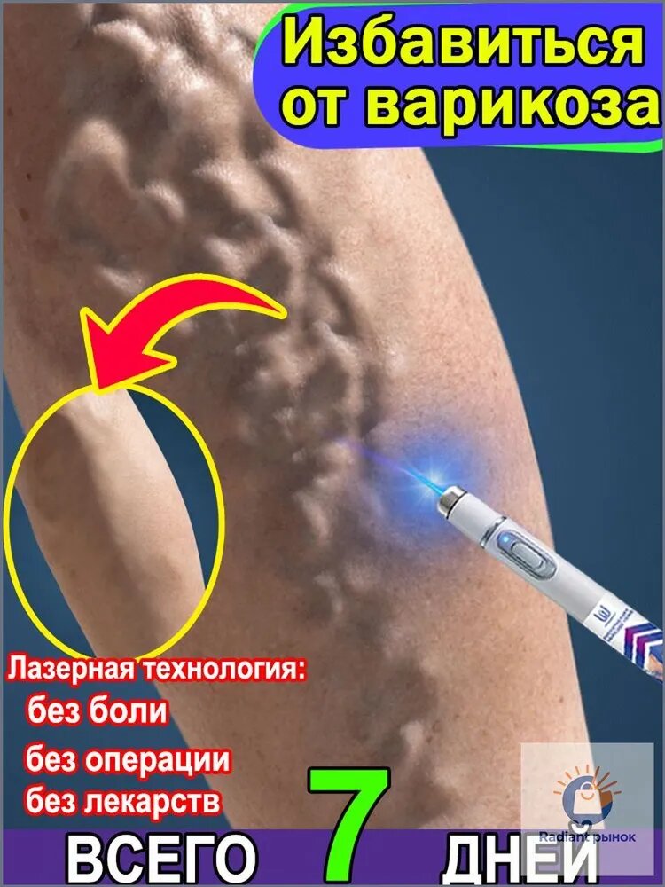 Варикозные вены. Устраняет тромбы, усталость ног и отеки. Способствует венозному кровообращению. Безболезненно и снимает усталость. Включает 1 лазерных аппарата.