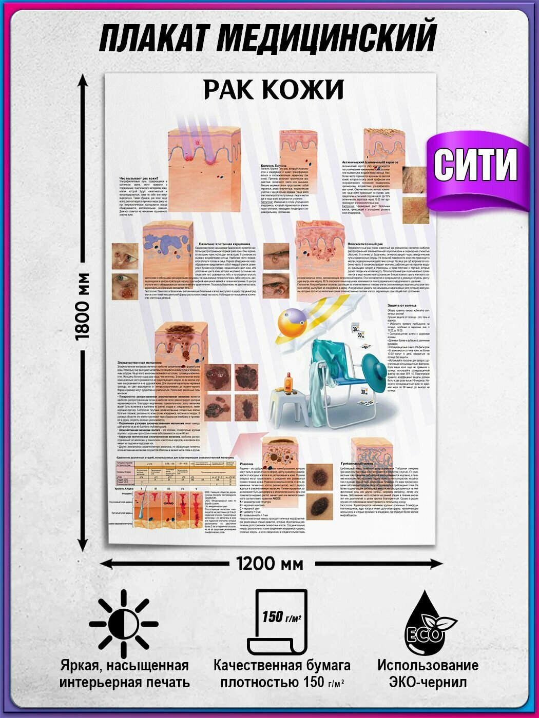 Информационный медицинский плакат "Рак кожи" / Формат сити (120х180 см.)