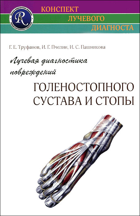 Лучевая диагностика повреждений голеностопного сустава и стопы