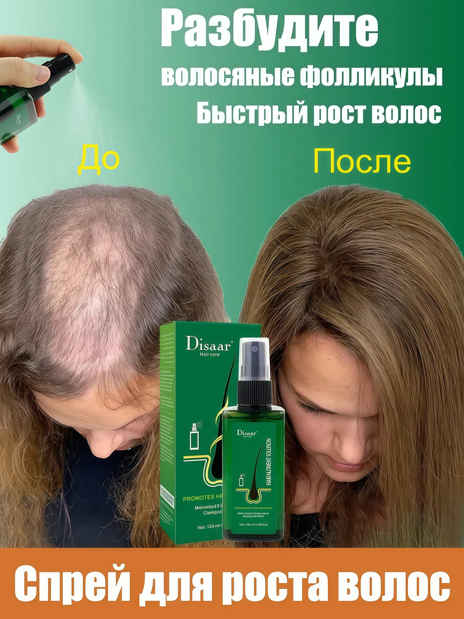 Для роста волос спрей-сыворотка с никотиновой кислотой, предотвращает выпадение и облысение, увеличивает густоту волос, 30 мл