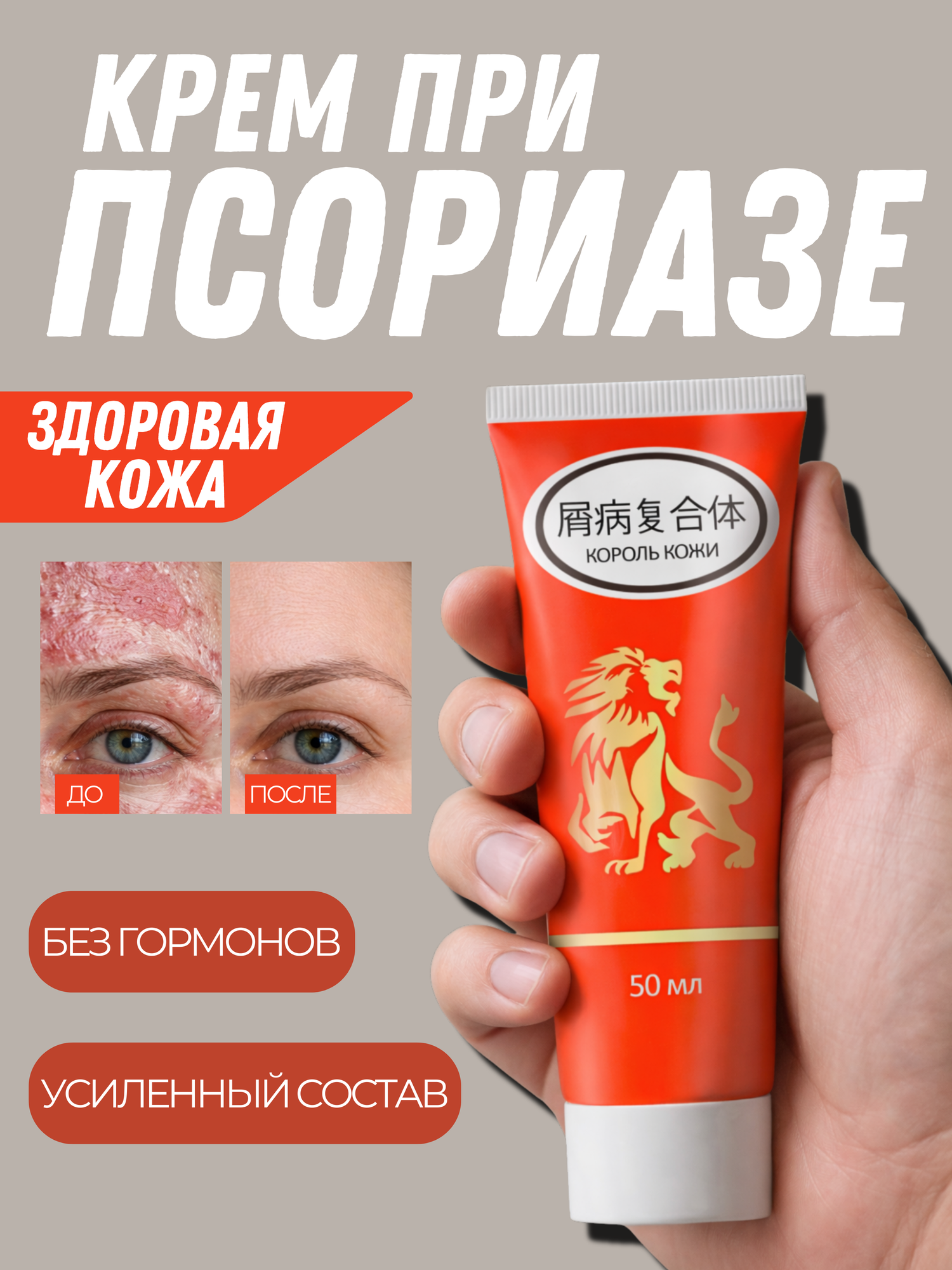 Крем от псориаза Король Кожи, активные ингредиенты, натуральный состав, туба, 50 мл