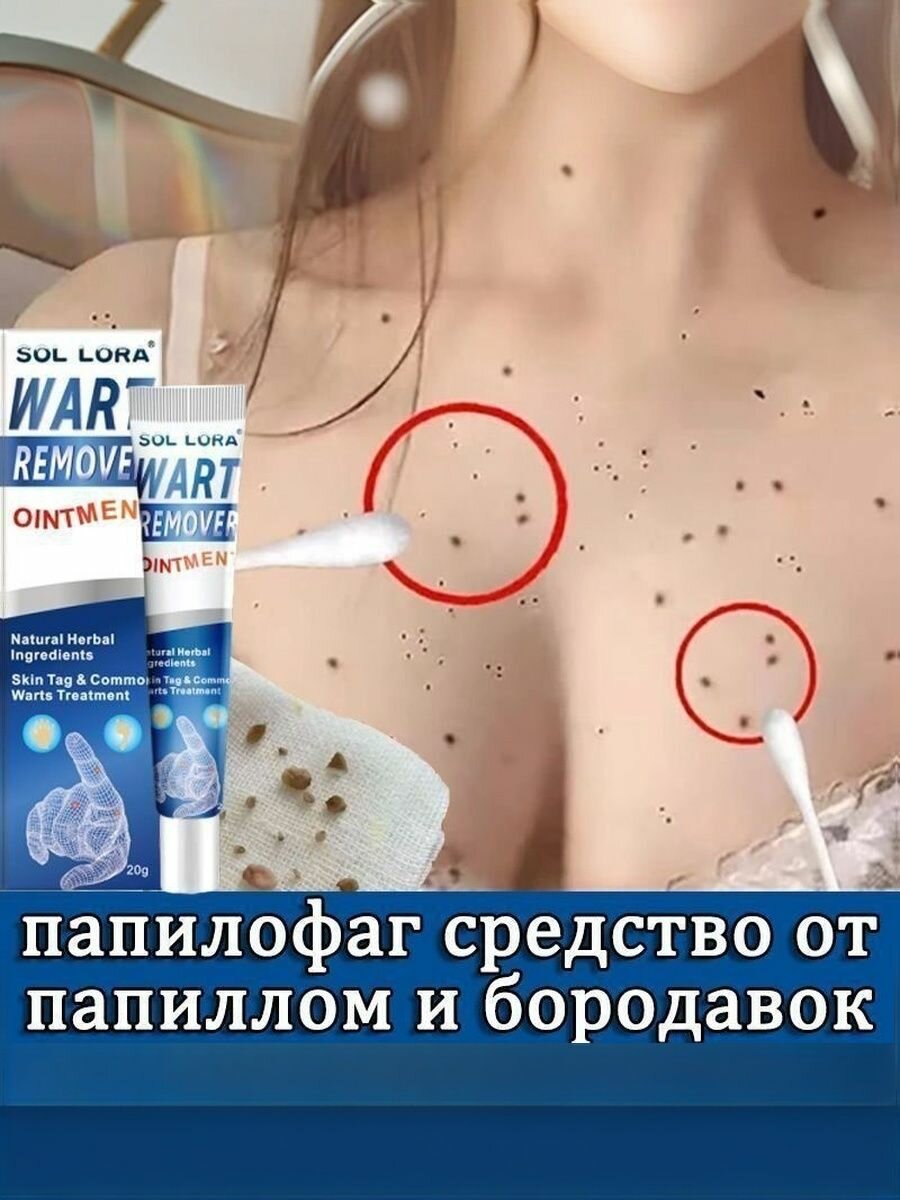 Крем от бородавок SOL LORA, средство для удаления папиллом и подошвенных бородавок, 20 г, быстрый эффект удаление новообразований средство от папиллом