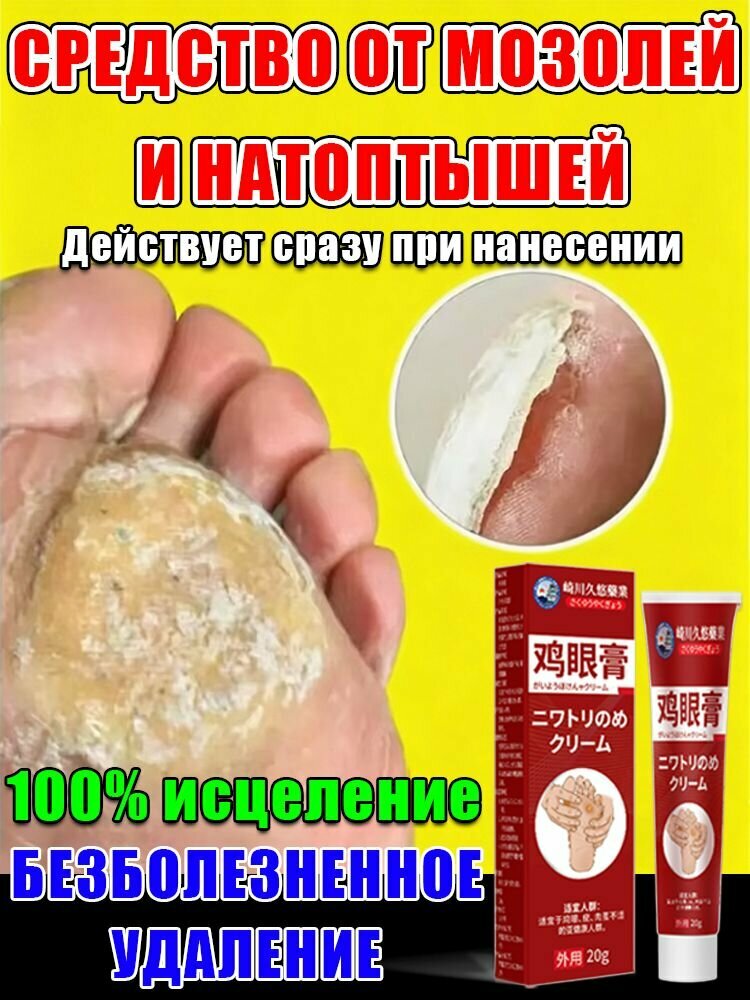 Мазь от стержневых мозолей на ногах смягчение и уход