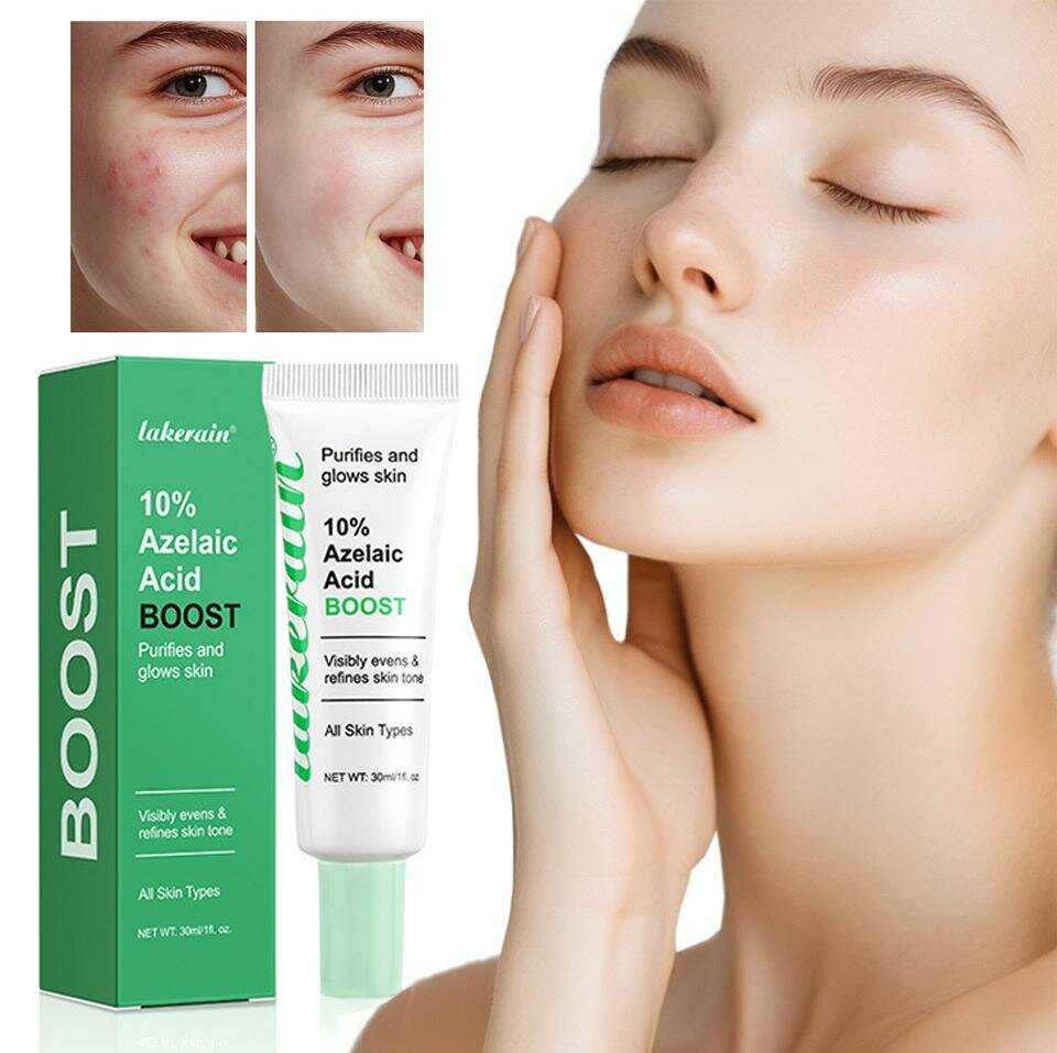 Эссенция Азелаиновой Кислоты Успокаивает Прыщи И Устраняет Закрытые Комедоны