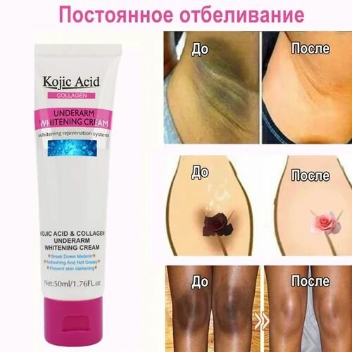 Осветляющий крем для тела, отбеливающий крем для подмышек, отбеливающий крем для интимной зоны, для зоны бикини, для декольте,50 г