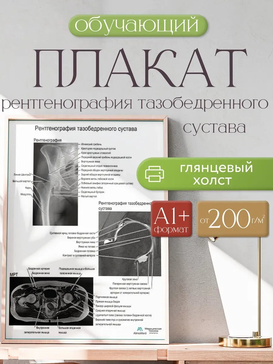 Обучающий плакат "Рентгенография тазобедренного сустава", размер А1+, глянцевый холст от 200г/м2