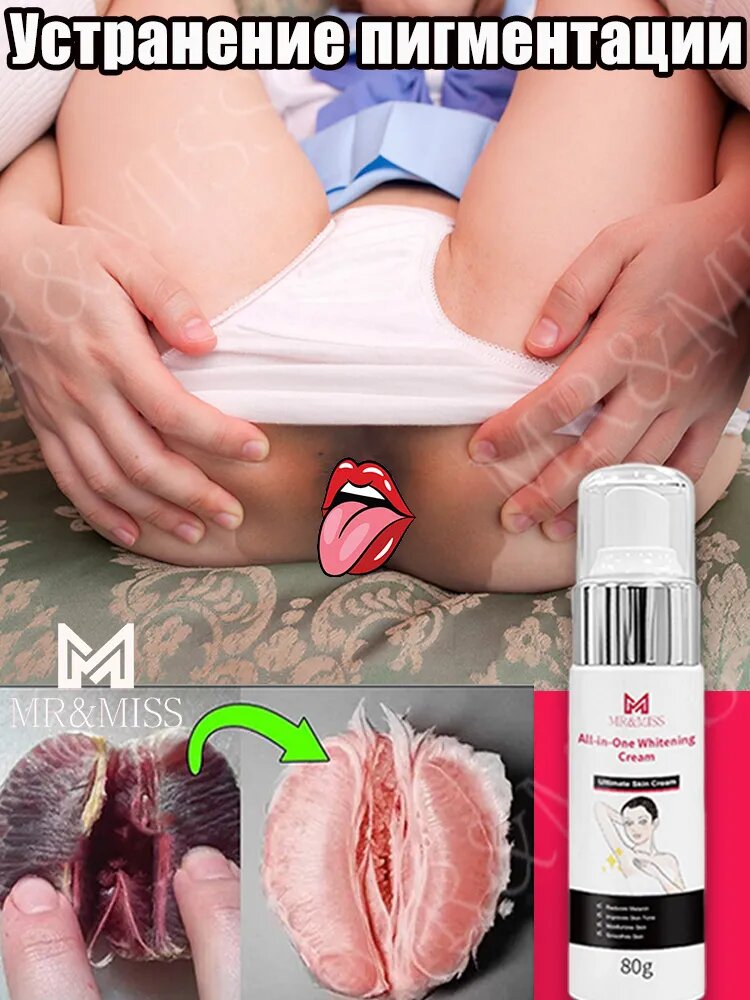 MR&MISS / отбеливающий крем для интимной зоны,80 г, для тела, интимных зон, локтей, подмышки, коленей, от пигментации с