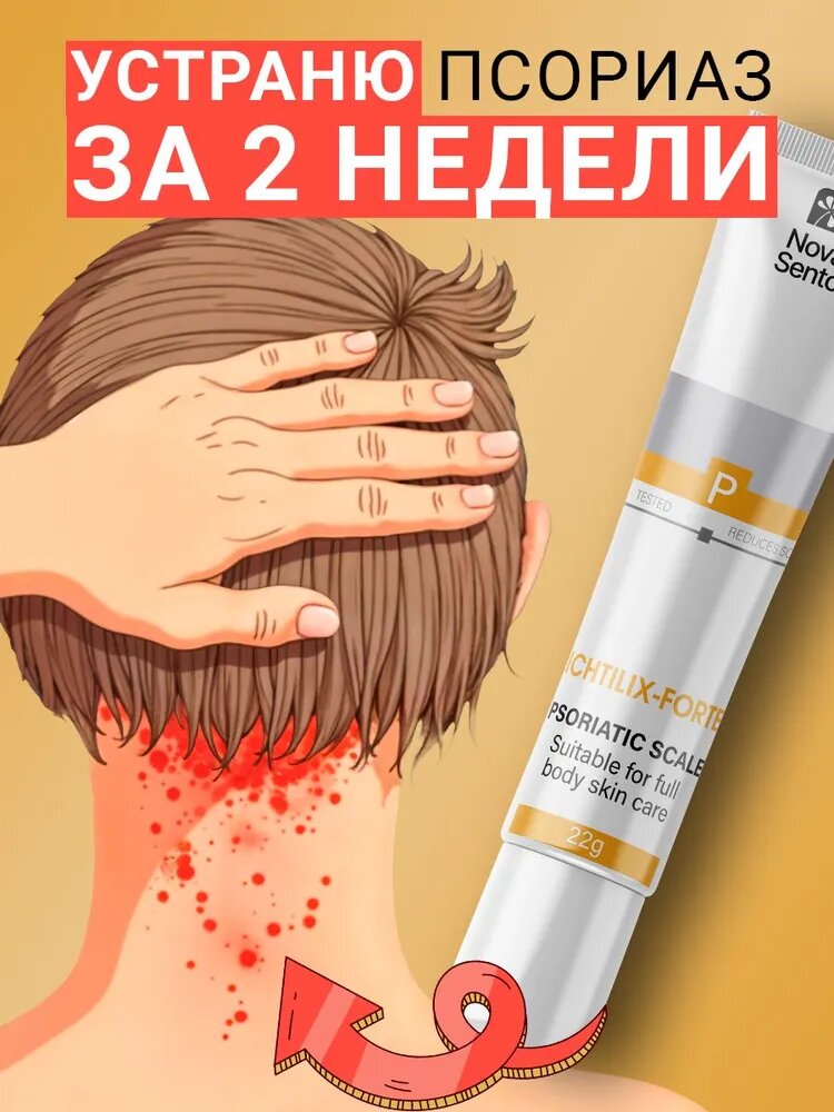 Ichtilix-Forte / Крем от псориаза, от дерматита, от экземы, от зуда, мазь от псориаза / 22 г