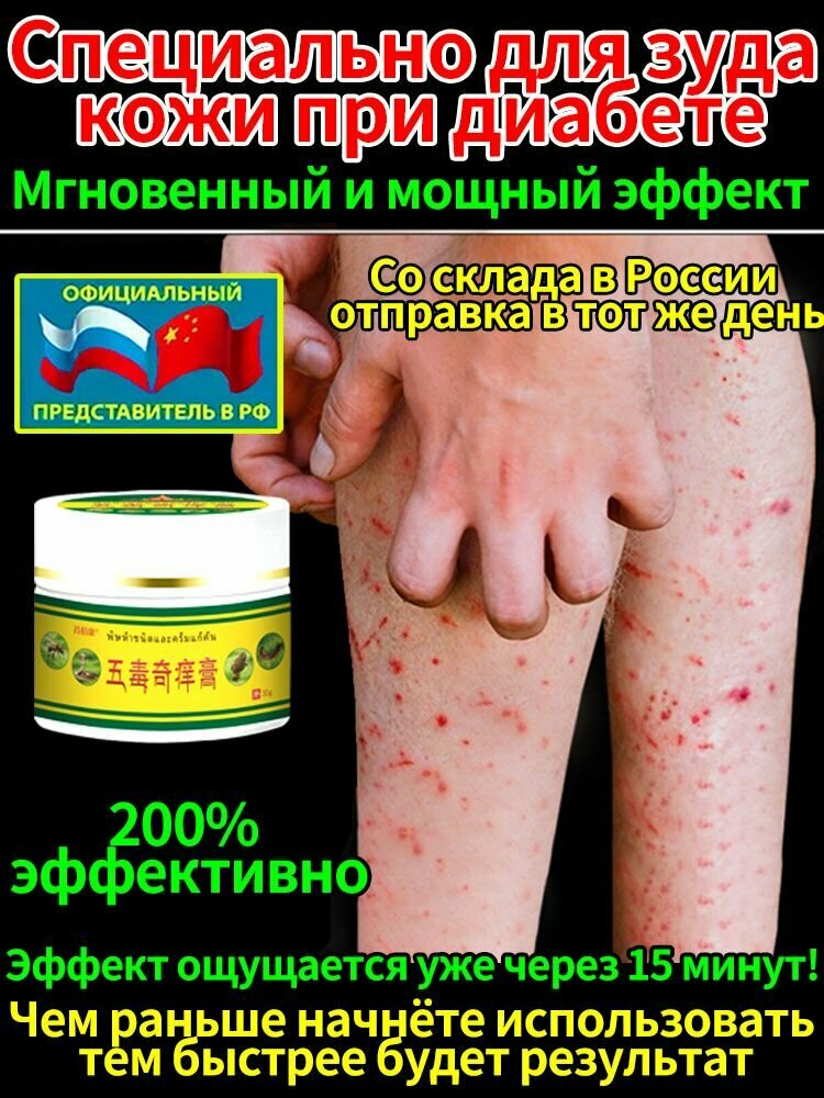 Мазь от кожного зуда, вызванного диабетом
