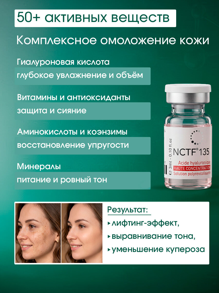 Биоревитализант Филорга NCTF 135 FillMed (Filorga) -1 флакон — фото 1