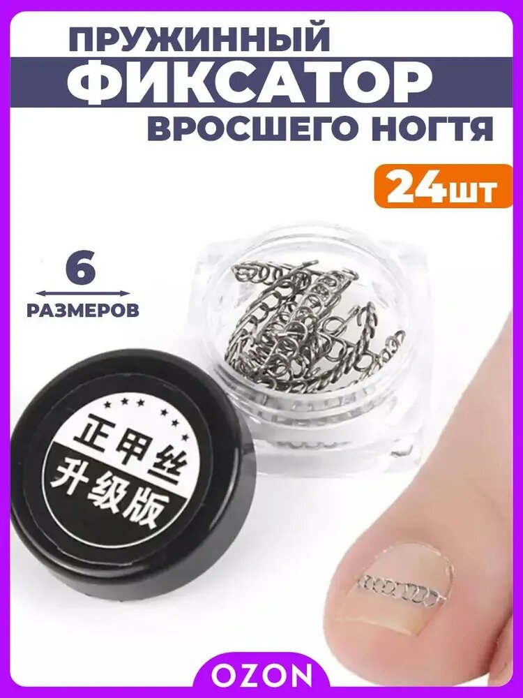 Корректор для вросшего ногтя скобы