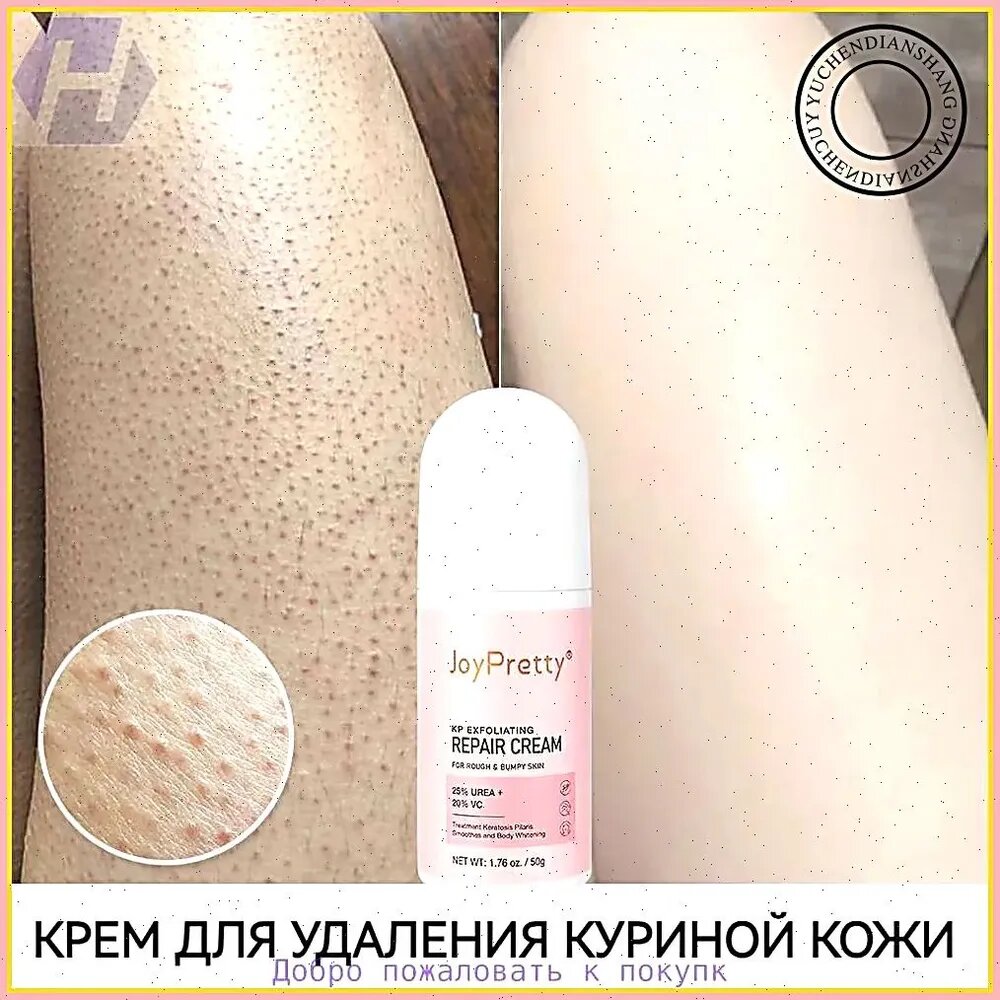 Крем для тела, средство удаления мозолей, лосьон против кератоза, уход за порами, увлажняющий отбеливающий 60г