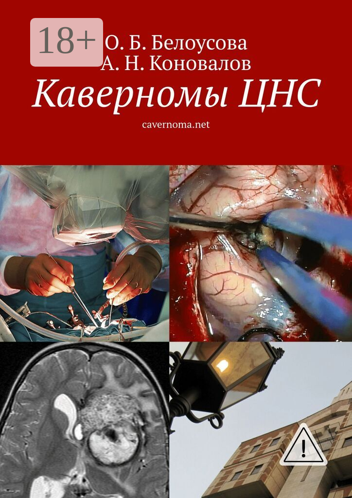 Каверномы ЦНС