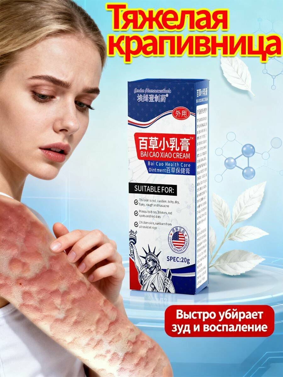 Мазь от крапивницы для взрослых и детей: быстрое снятие зуда, отека и сыпи на коже. Комплексное лечение всех видов аллергической крапивницы (острой и хронической).