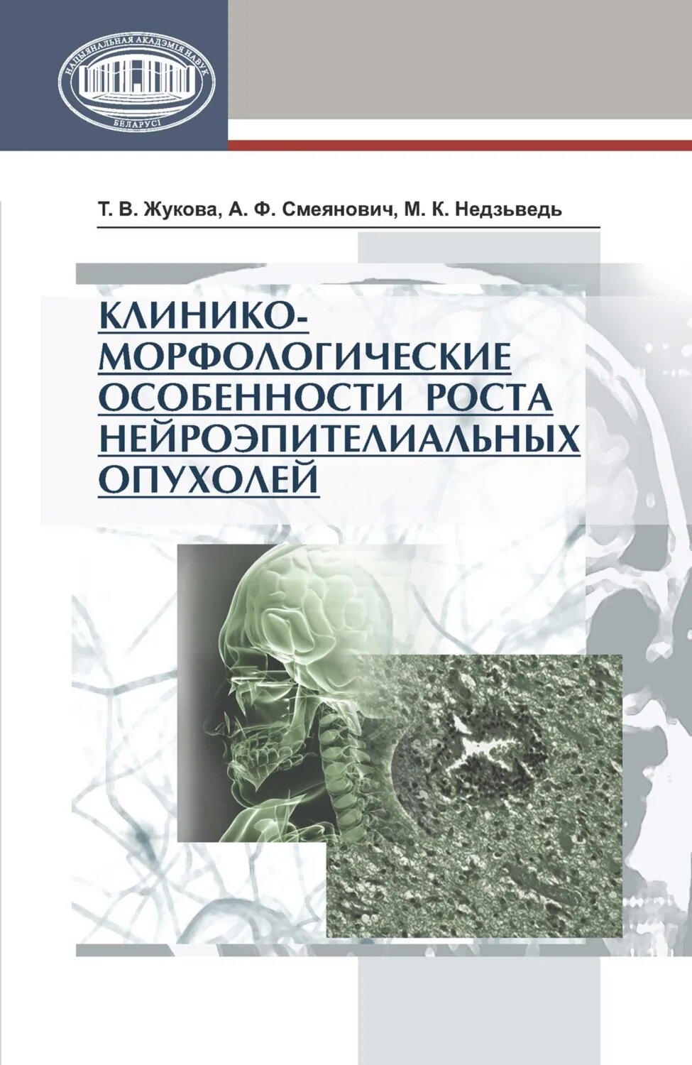 Клинико-морфологические особенности роста нейроэпителиальных опухолей [Цифровая книга]