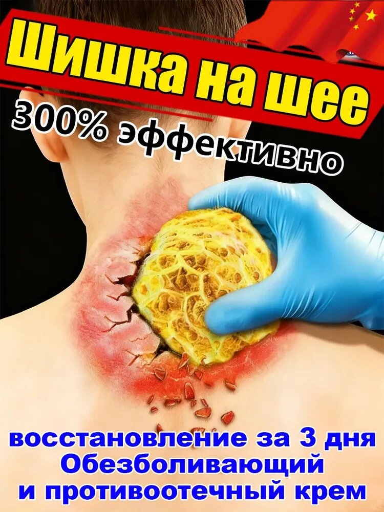 Мазь от холки на спине китай, вдовьего горба на шее, Помогает вылечить при шишке на шее, сдавлении нерва, боли и припухлости, мазь от остеохондроза шеи и спиныАнальгетики