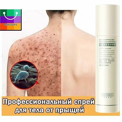 Спрей для ухода за кожей