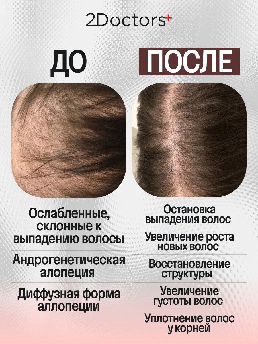 2Doctors Шампунь для волос — фото 1